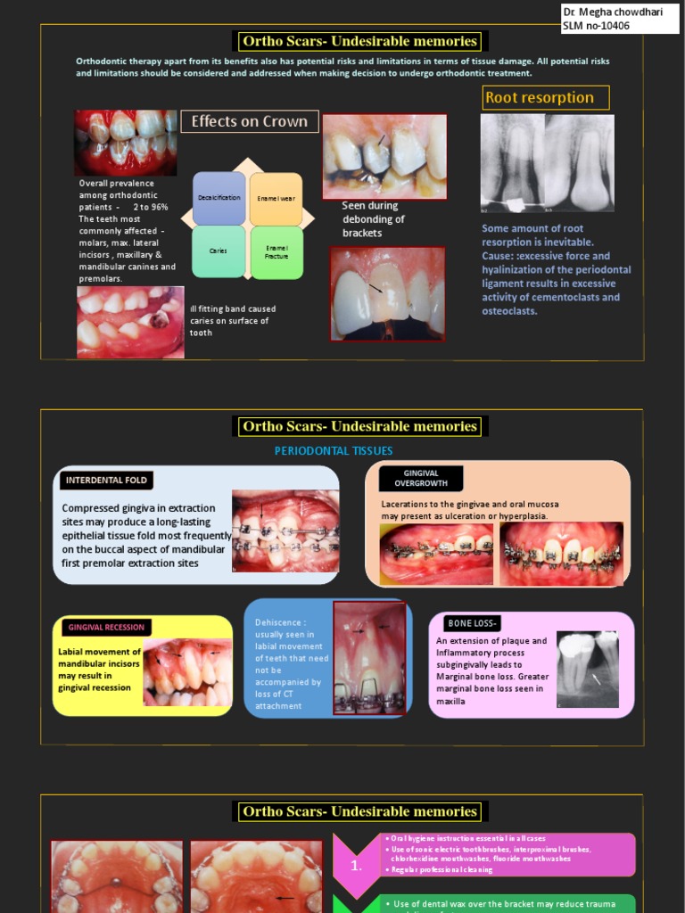 POSTER | PDF | Human Tooth | Periodontology