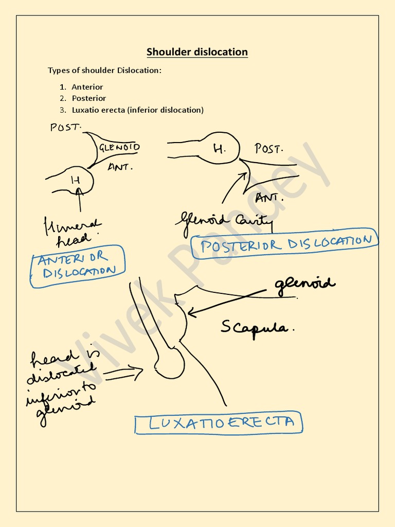 Shoulder Dislocation | PDF | Shoulder | Anatomical Terms Of Motion