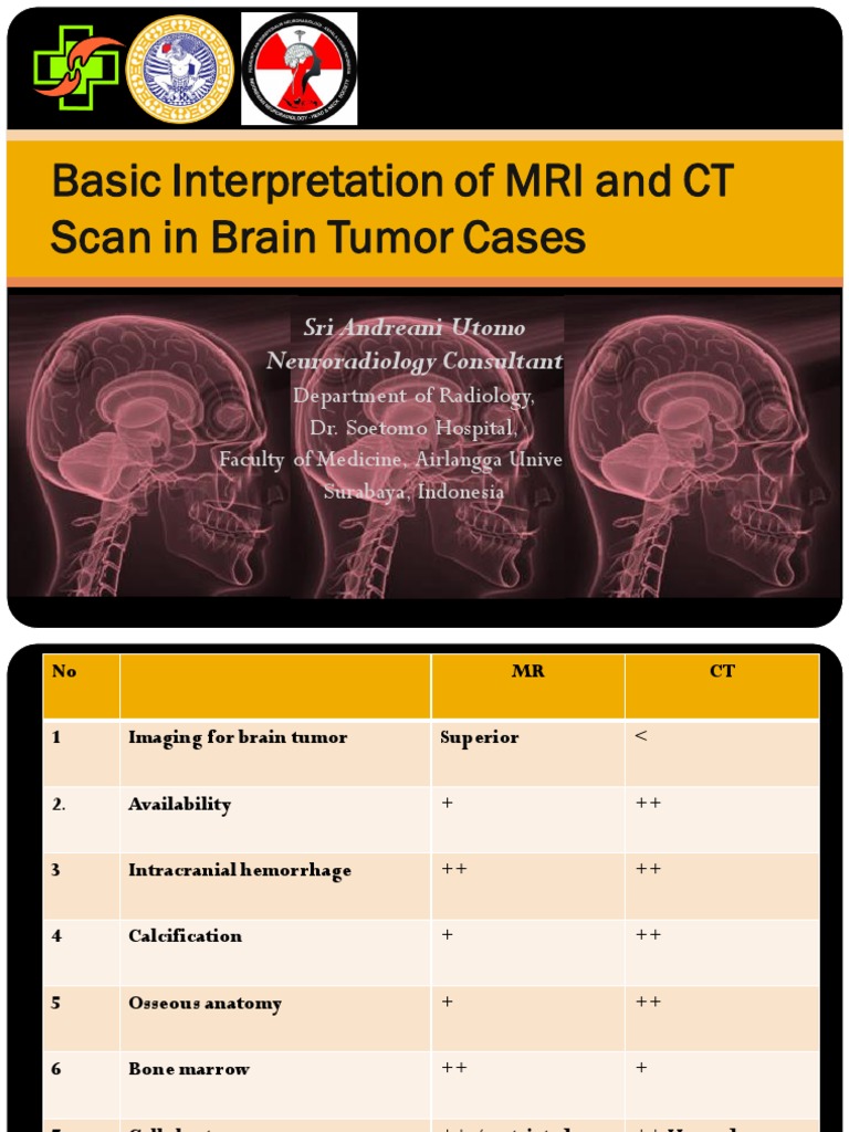 Basic Interpretation of MRI and CT Scan in Brain Tumor Cases | PDF ...