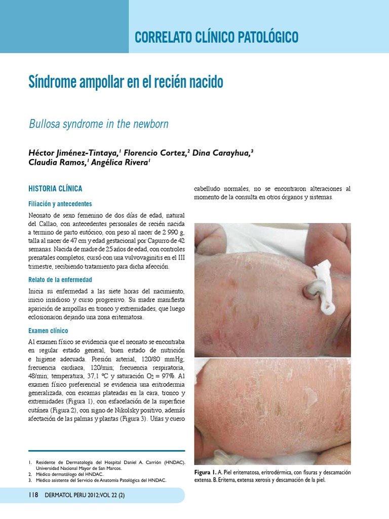 Dermatosis Ampollosa Neonatal PDF | PDF | Epidermis | Piel
