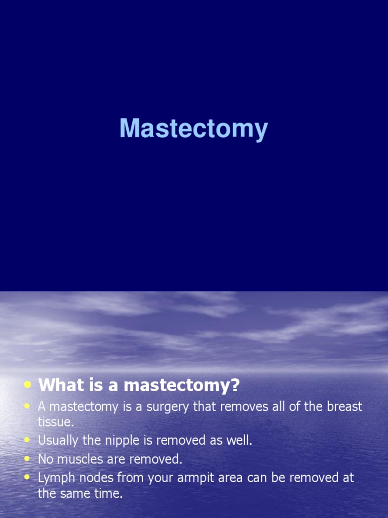 Mastectomy.ppt | Mastectomy | Breast Cancer