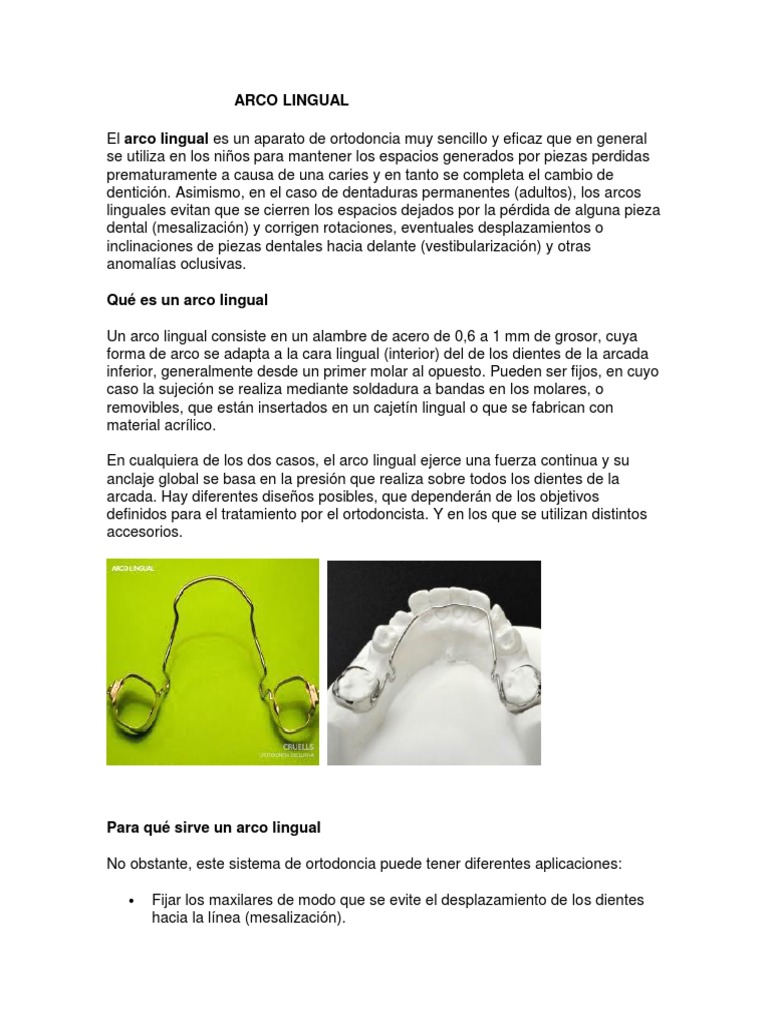 Arco Lingual | PDF | Ortodoncia | Odontología