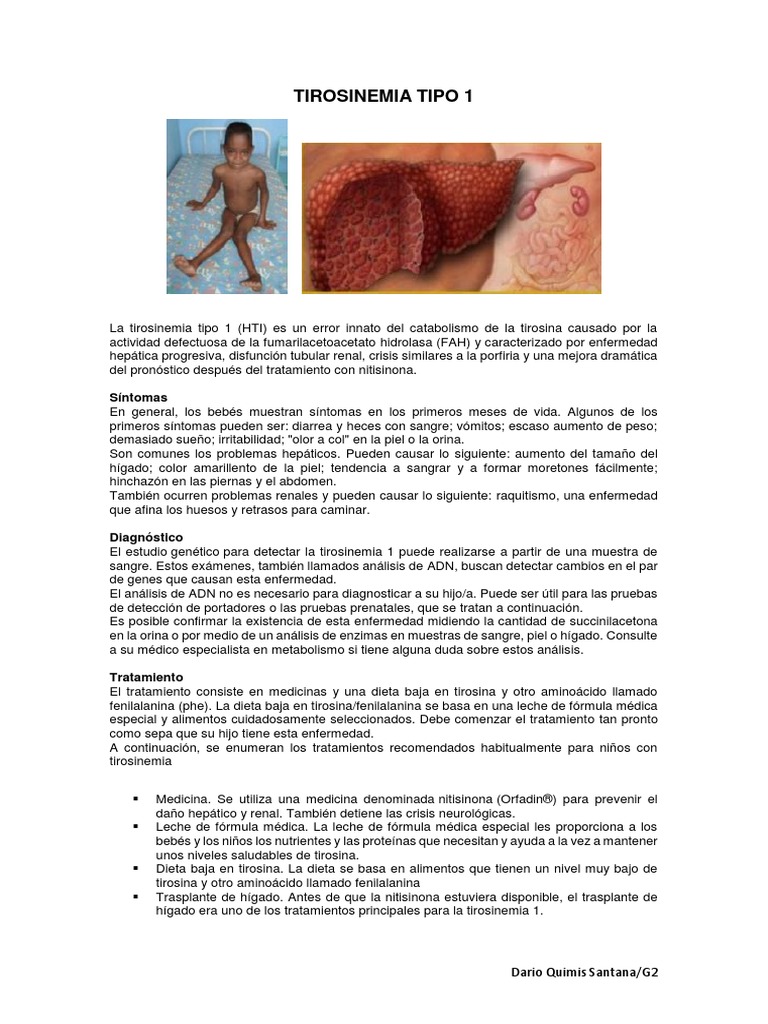 Tirosinemia Tipo 1 | PDF | Fenilalanina | Tirosina
