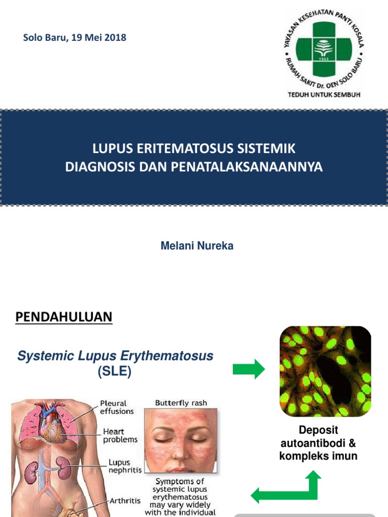 Diagnosis dan Penatalaksanaan SLE | PDF | Sains & Matematika