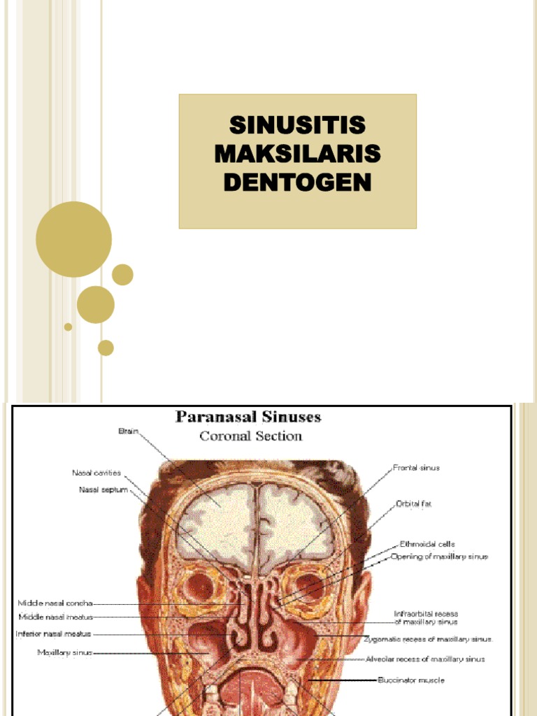 SINUSITIS | PDF | Kajian Bahasa Asing | Kesehatan Holistik