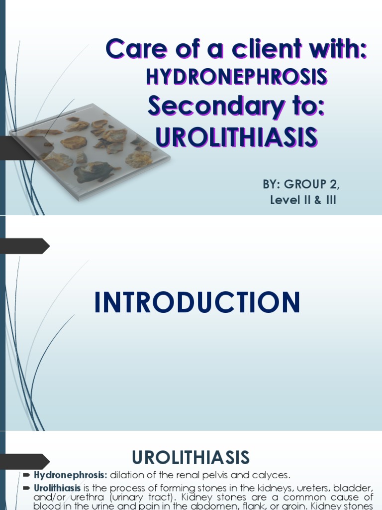 UROLITHIASIS | PDF | Kidney | Urology