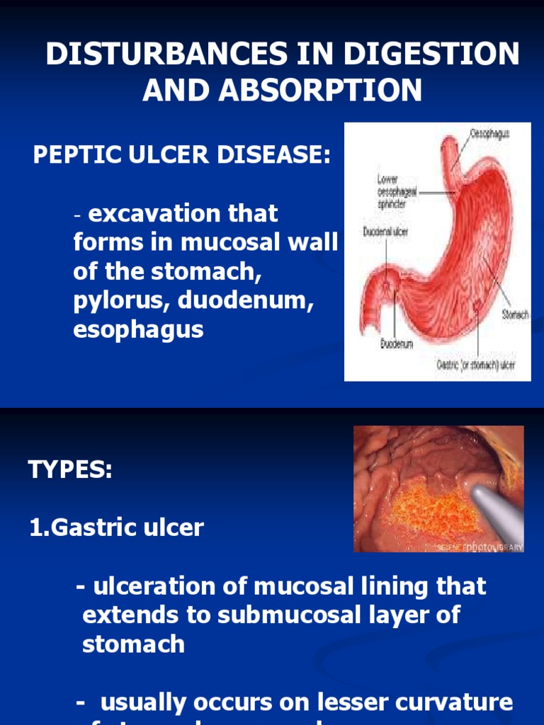 Disturbances in Digestion and Absorption | PDF