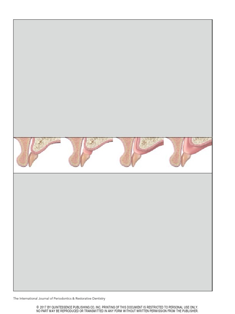 Lip Tooth Ridge Classification | PDF