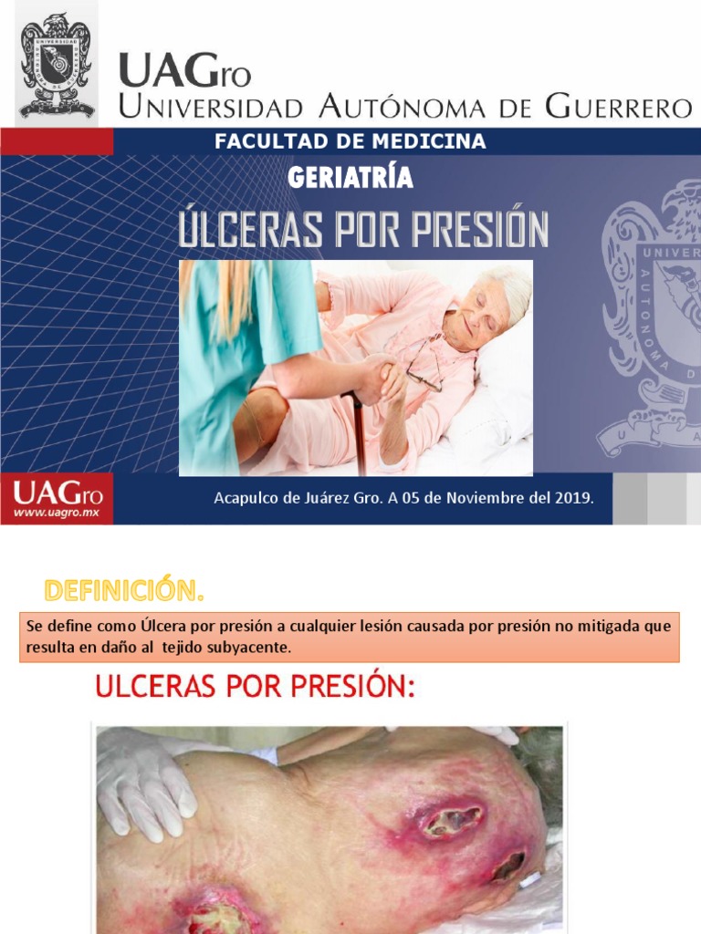 Úlceras Por Presión | PDF