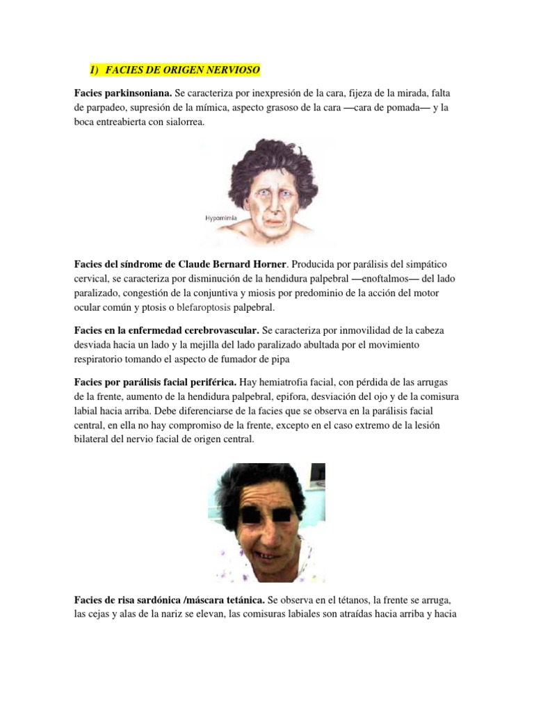 Facies Parkinsoniana