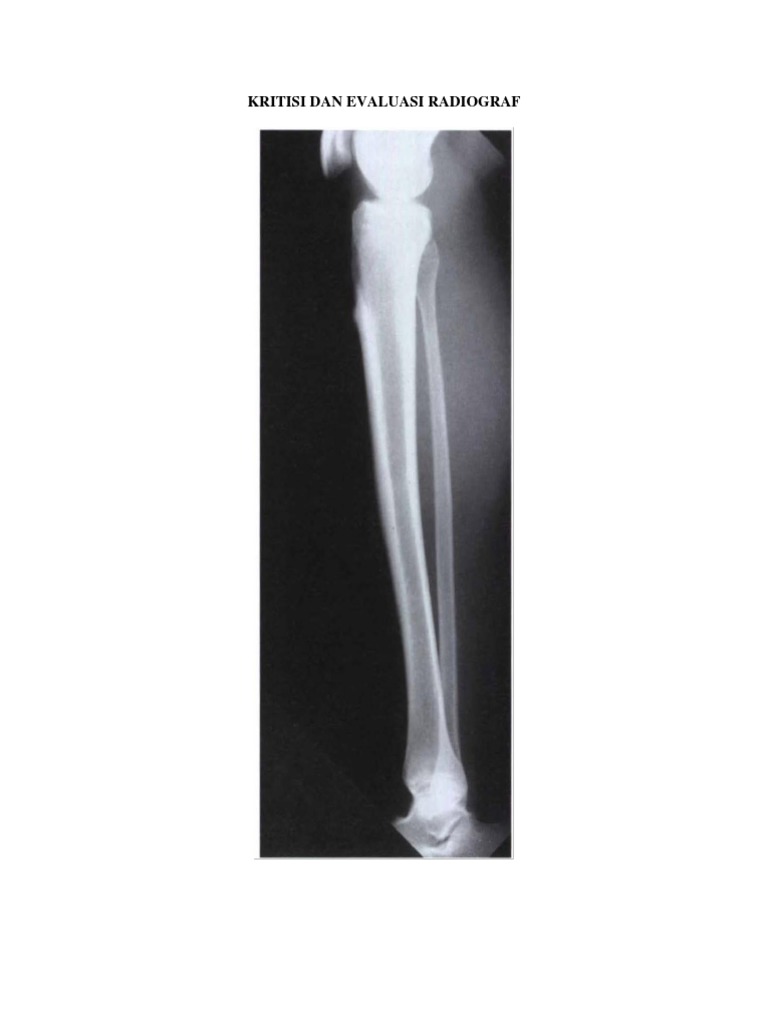 KRITISI DAN EVALUASI RADIOGRAF Cruris | PDF