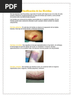 Clasificación de Los Tipos de Heridas | PDF | Piel | Herida