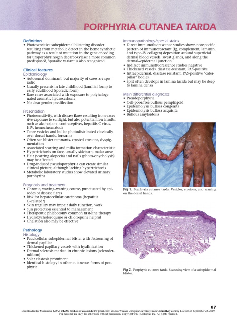 Porphyria Cutanea Tarda Histology