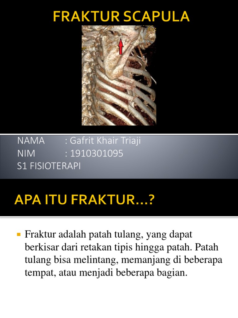 Fraktur Scapula | PDF