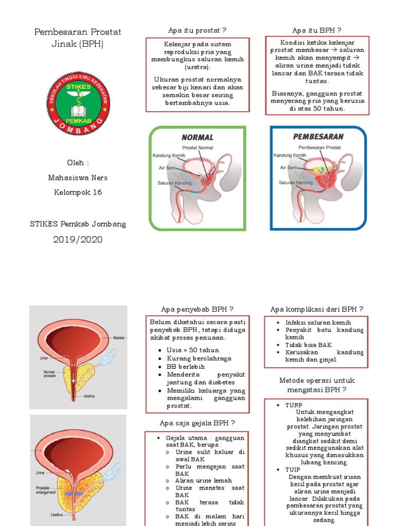 Gejala Dan Penanganan Pembesaran Prostat Benign Bph Pdf