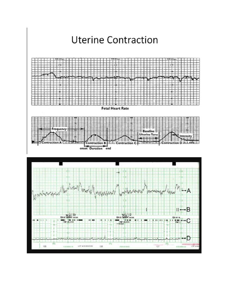 CTG | PDF
