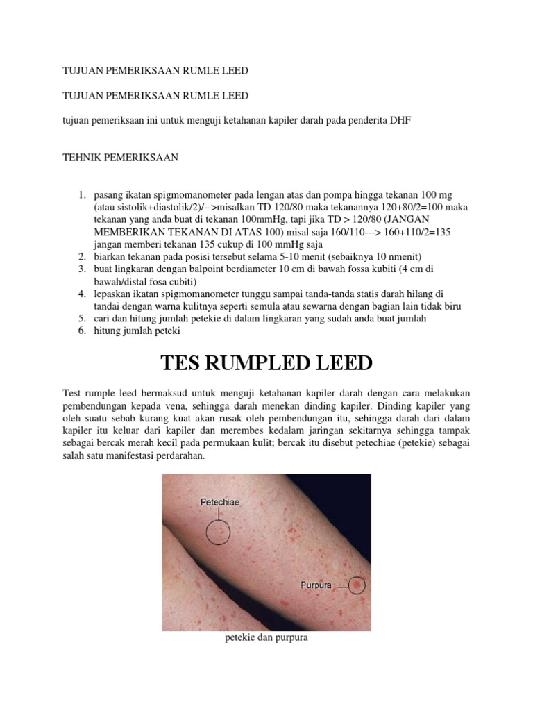 TUJUAN PEMERIKSAAN RUMLE LEED Sri Siswati | PDF | Sains & Matematika