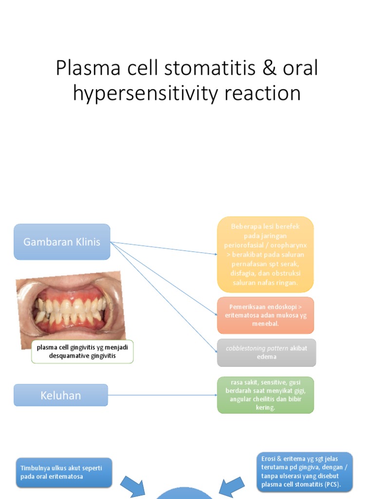 Plasma Cell Stomatitis & Oral Hypersensitivity Reaction | PDF