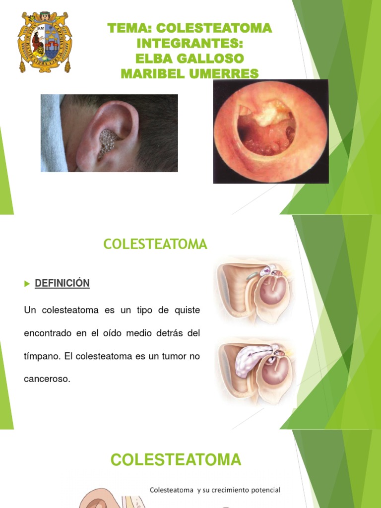 Colesteatoma: Definición y Tratamiento | PDF