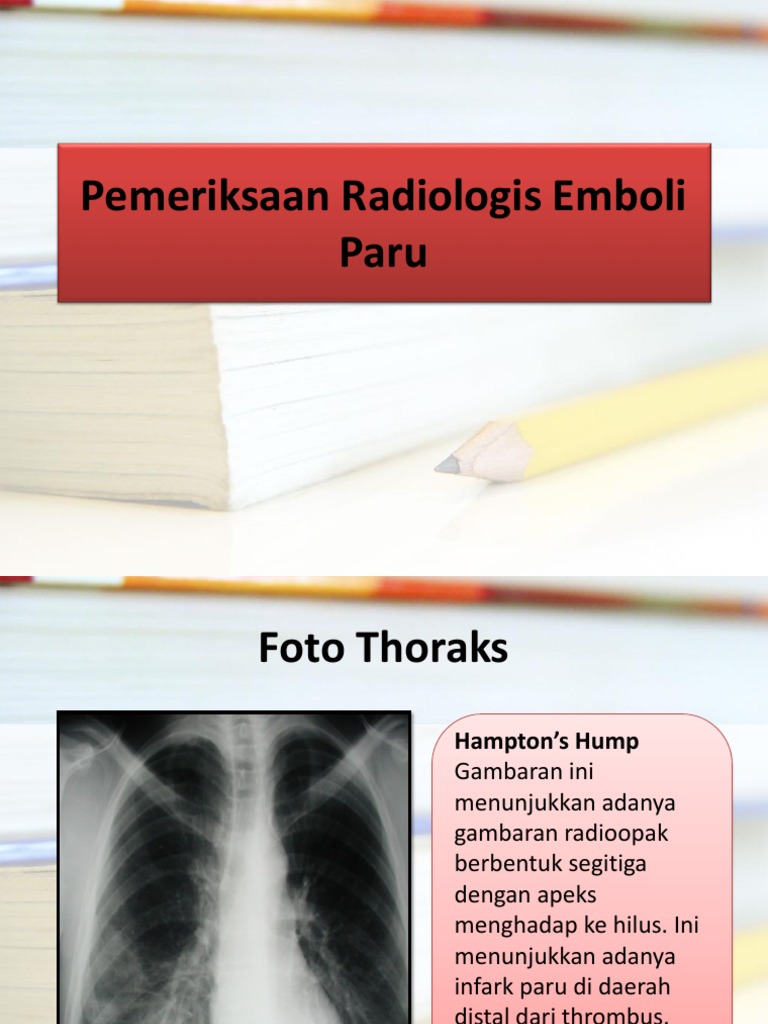 Dokumen - Tips - Pemeriksaan Radiologis Emboli Paru | PDF | Sains ...