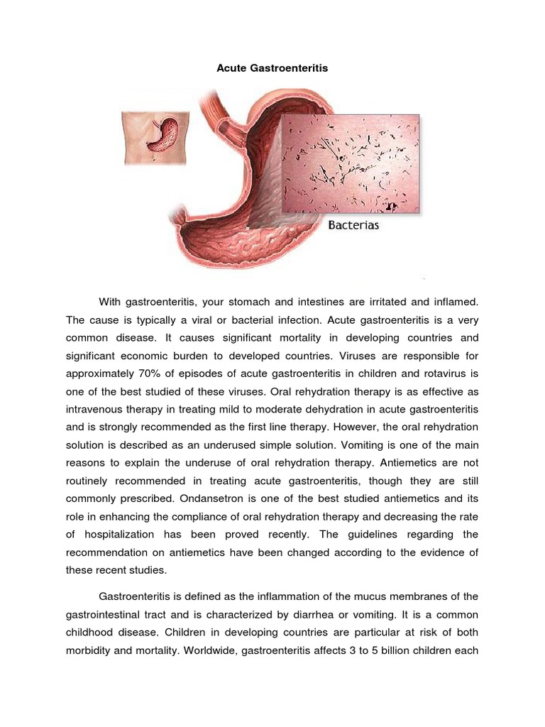 Pediatric Acute Gastroenteritis Overview | PDF