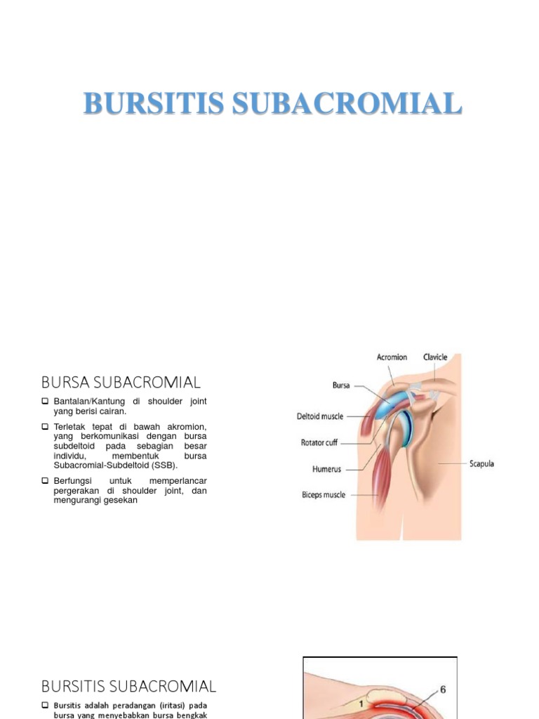 Bursitis Subacromial | PDF