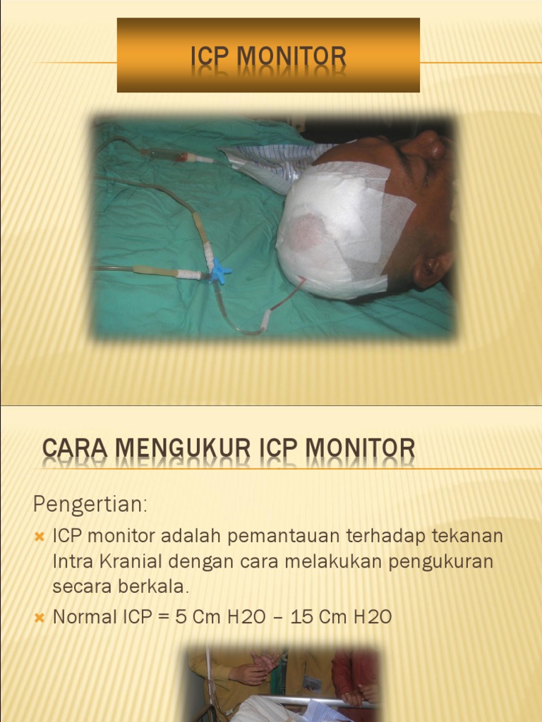 ICP Monitor - Workshop | PDF