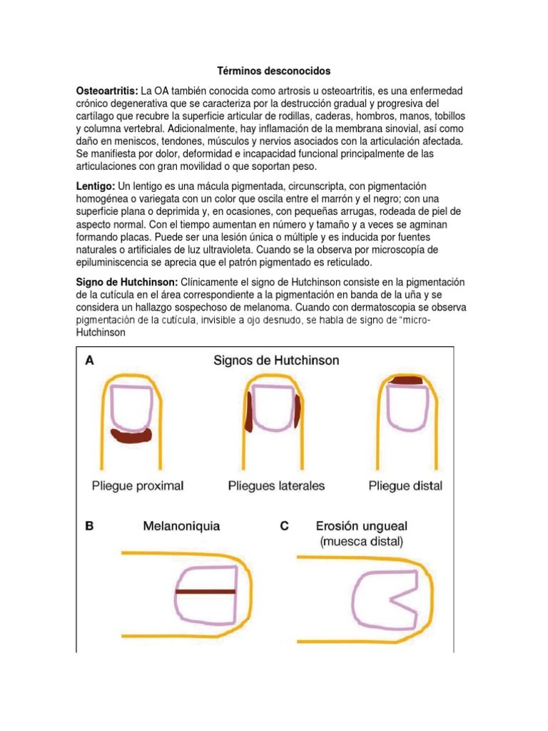 Signo de Hutchinson y melanoma ungueal | PDF