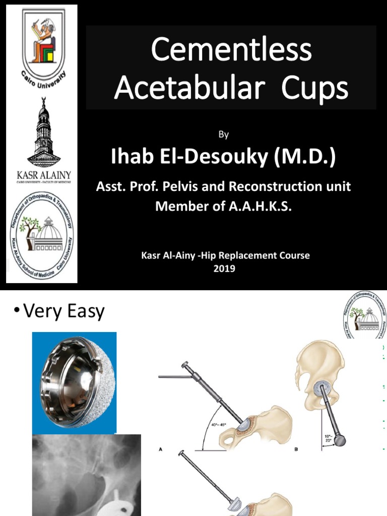 Cementless Acetabular Cups | PDF | Technology & Engineering