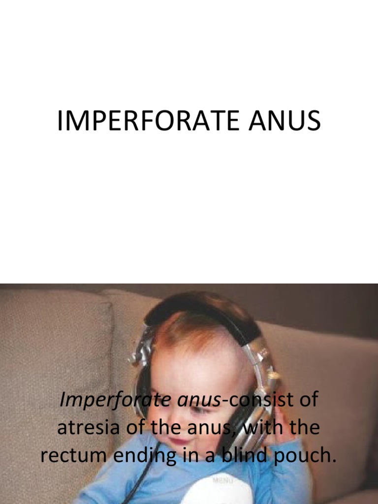 Understanding Imperforate Anus: Causes & Care | PDF | Health Sciences ...