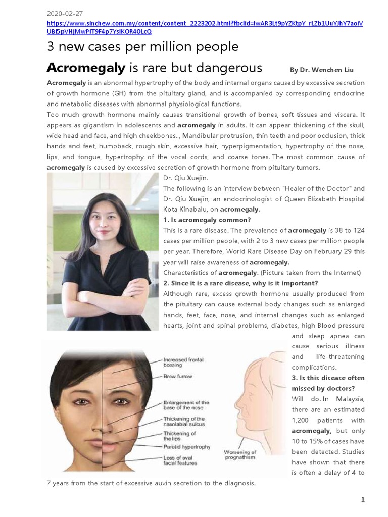 Acromegaly Feb2020 | PDF | Growth Hormone | Human Anatomy