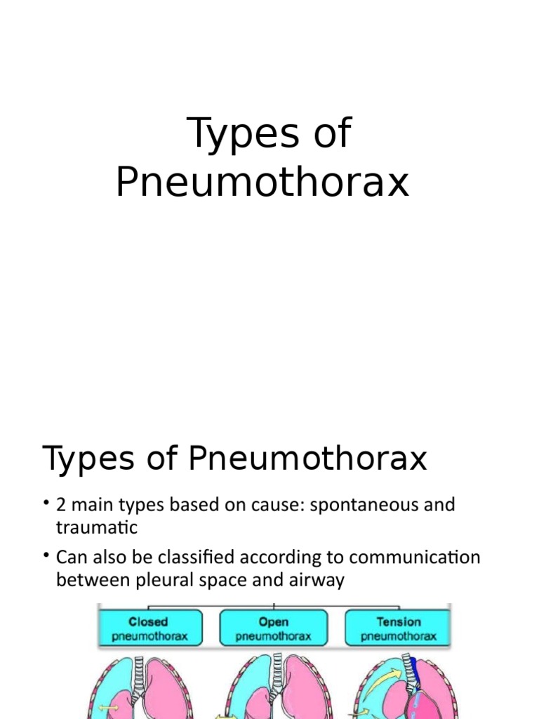 Types of Pneumothorax | PDF | Respiratory Diseases | Lung