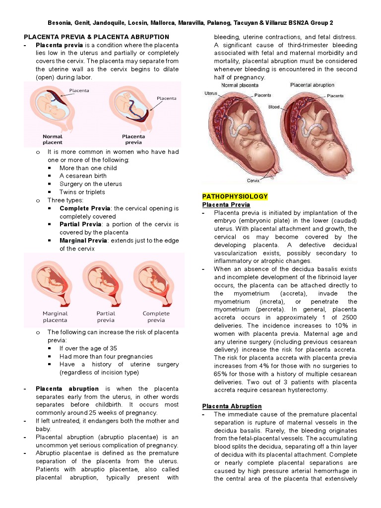 Placenta Previa & Abruption