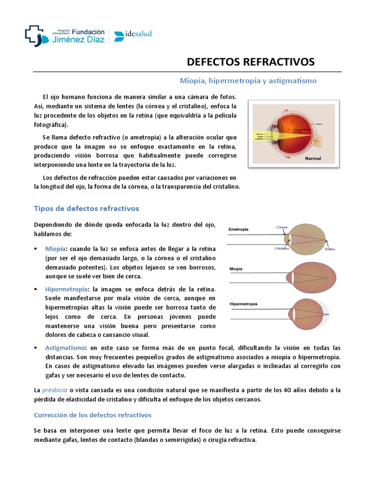 Defectos Refractivos PDF | PDF