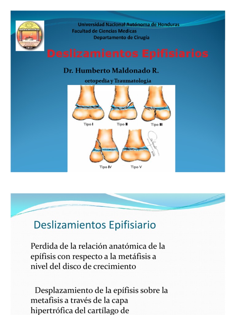 Epifisiolisis PDF | PDF | Cartílago | Hueso