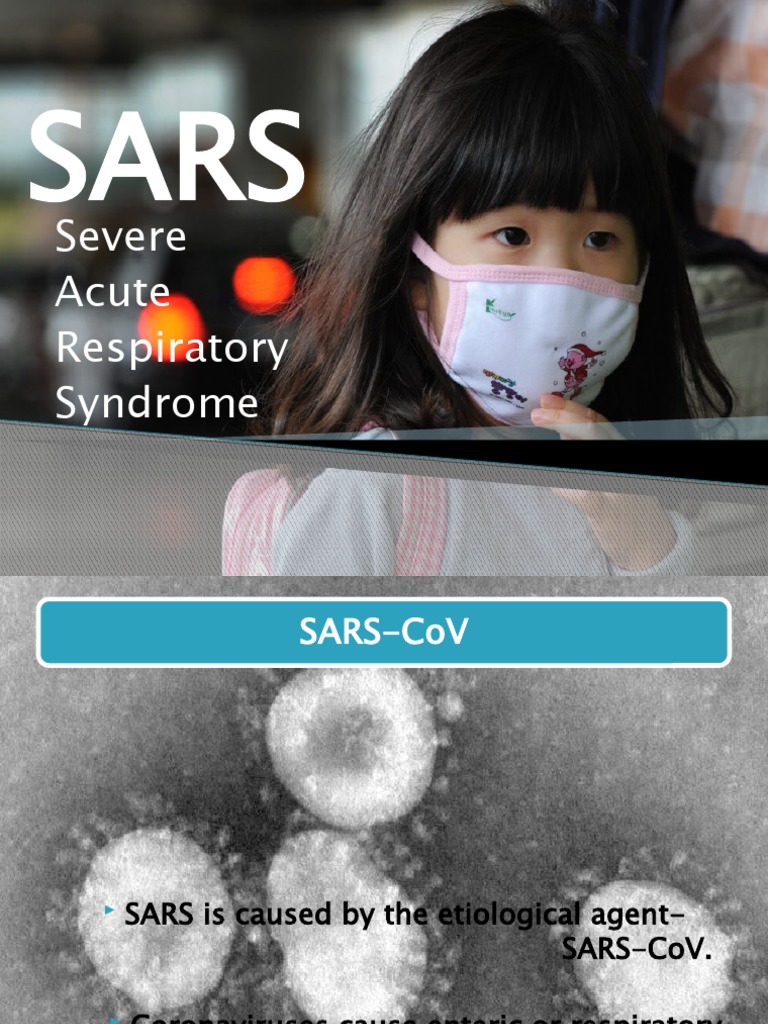 Understanding SARS: Causes, Symptoms, and Prevention | PDF | Infection ...