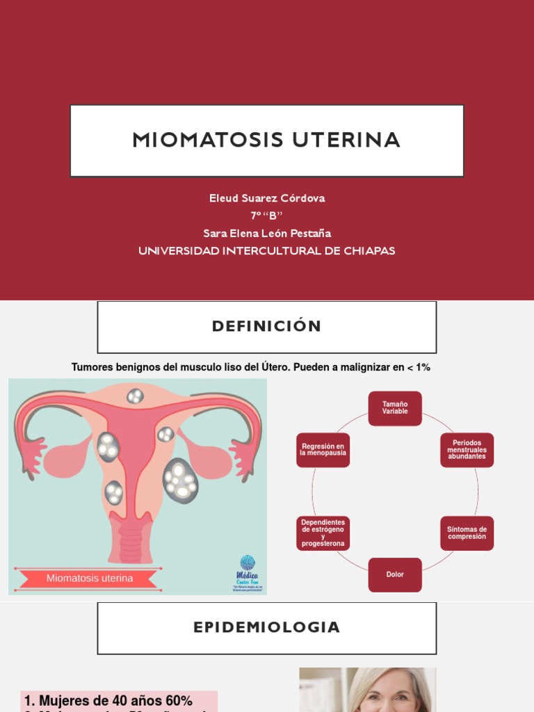 Miomatosis Uterina | PDF | Útero | Reproducción humana