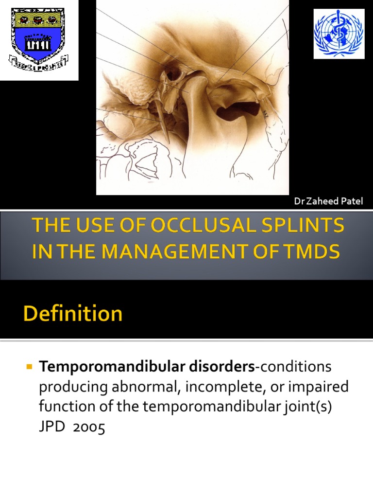 Occlusal Splints | PDF | Myofascial Trigger Point | Clinical Medicine