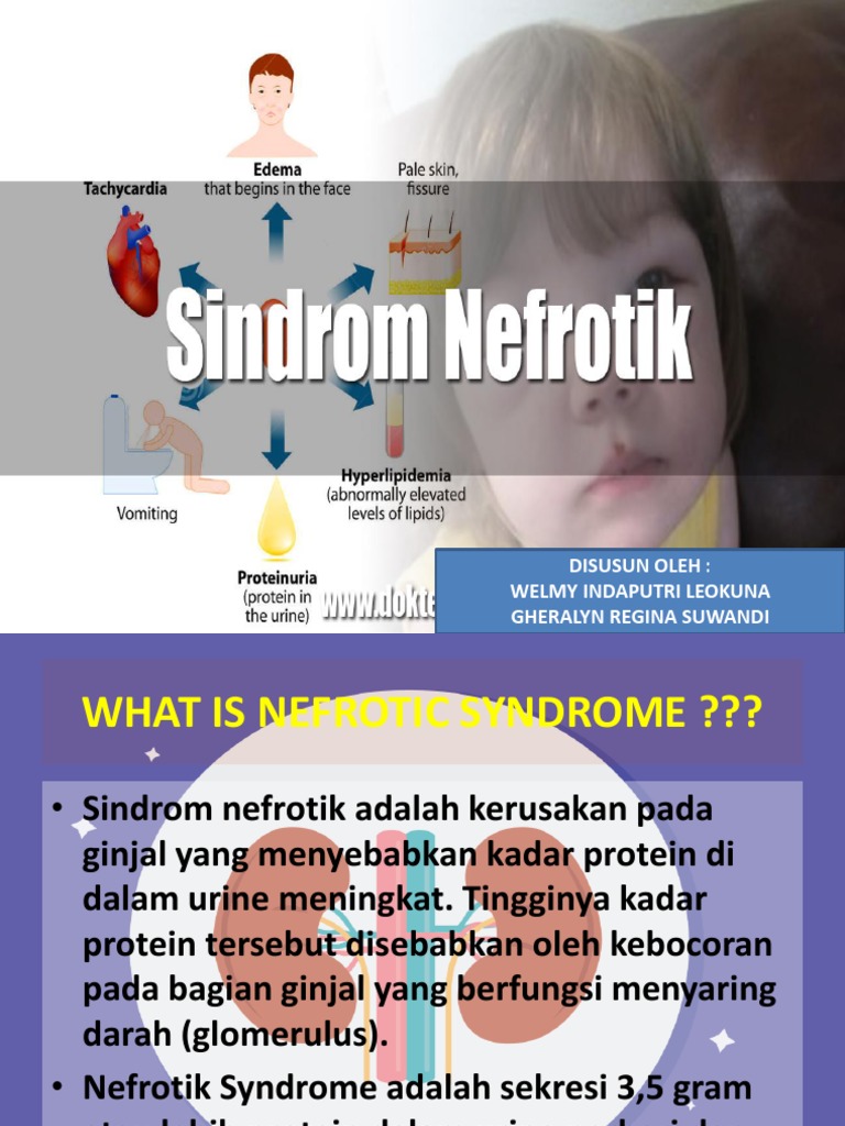 Nefrotik Syndrome | PDF