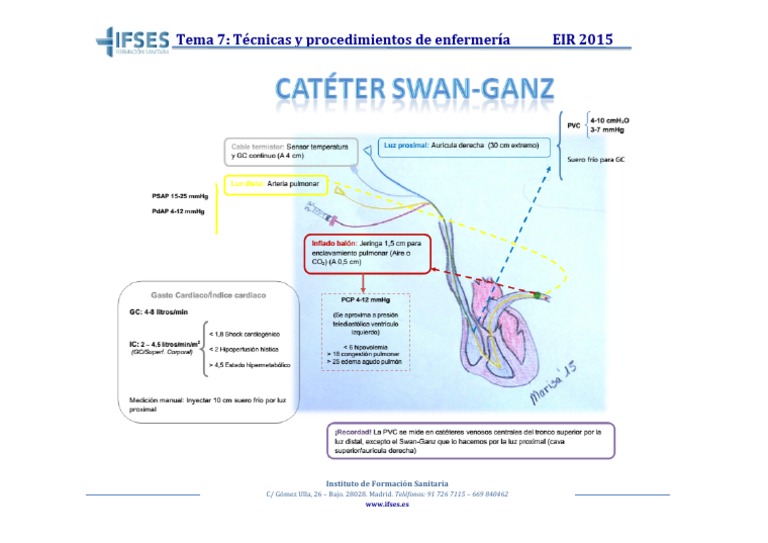 Catéter Swan-Ganz PDF | PDF