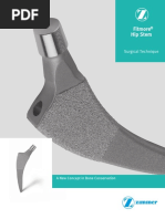 015 Exeter V40 Femoral Stem Using Modular Broach Surgical Technique For ...