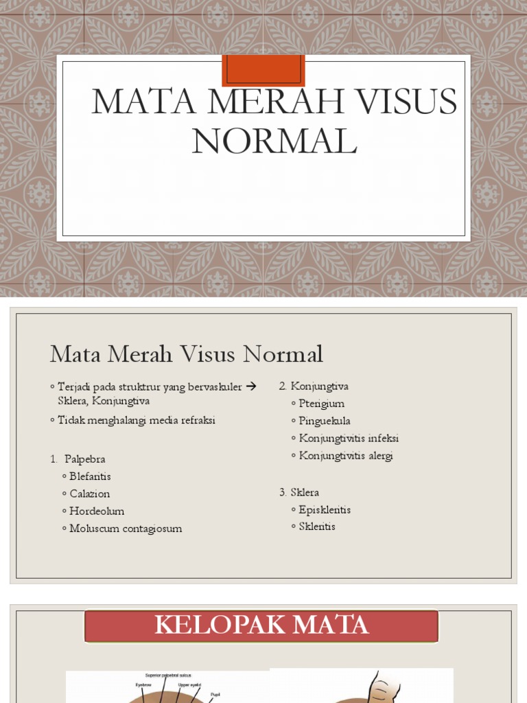Mata Merah Visus Normal | PDF