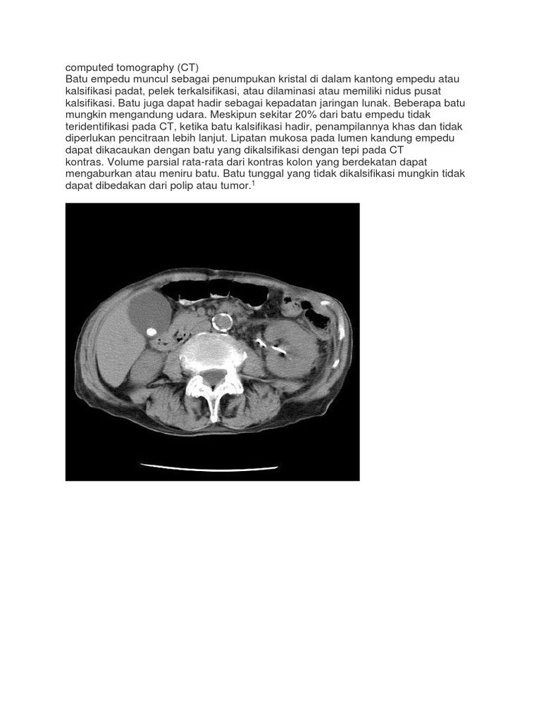 Computed Tomography | PDF