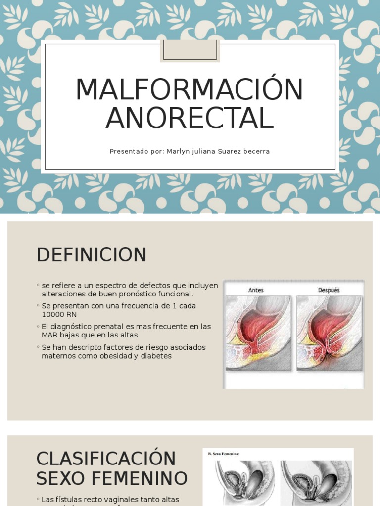 Malformación Anorectal | PDF