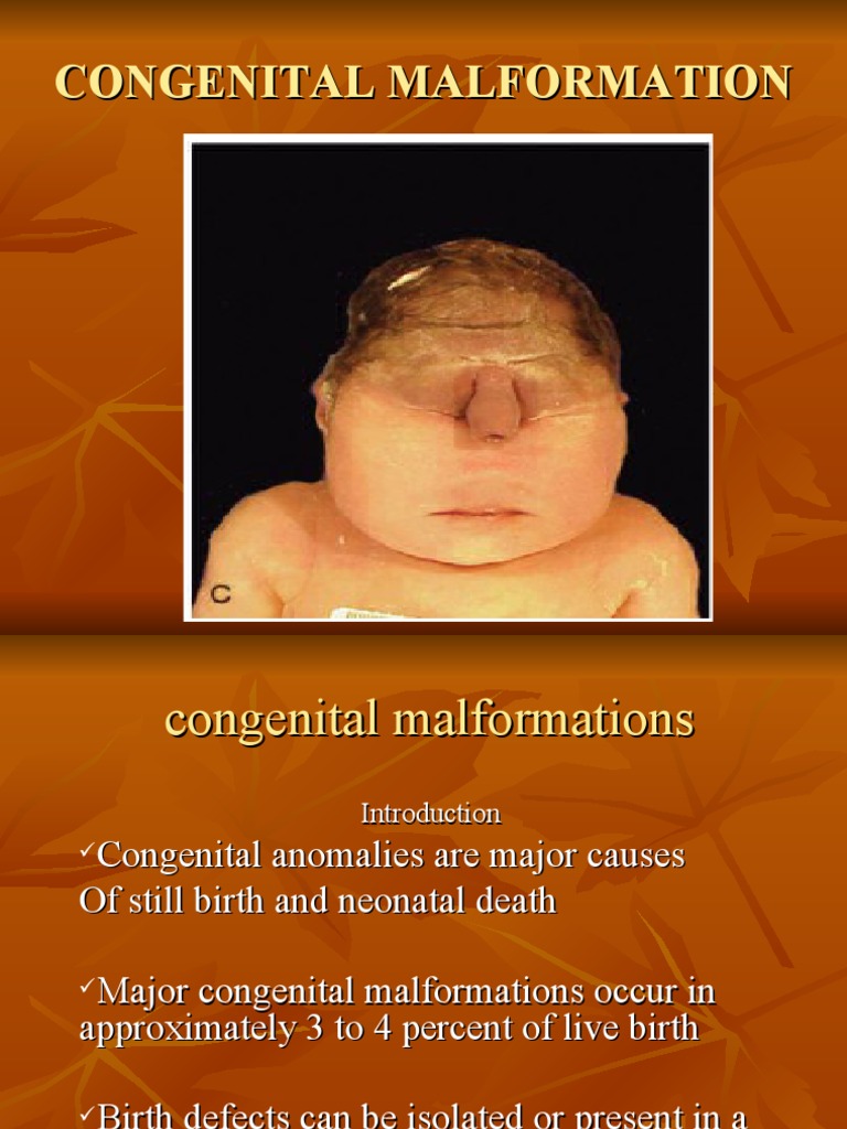 Congenital Malformations Lecture | PDF | Diseases And Disorders ...