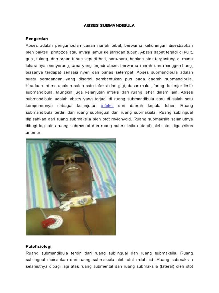 Abses Submandibula | PDF