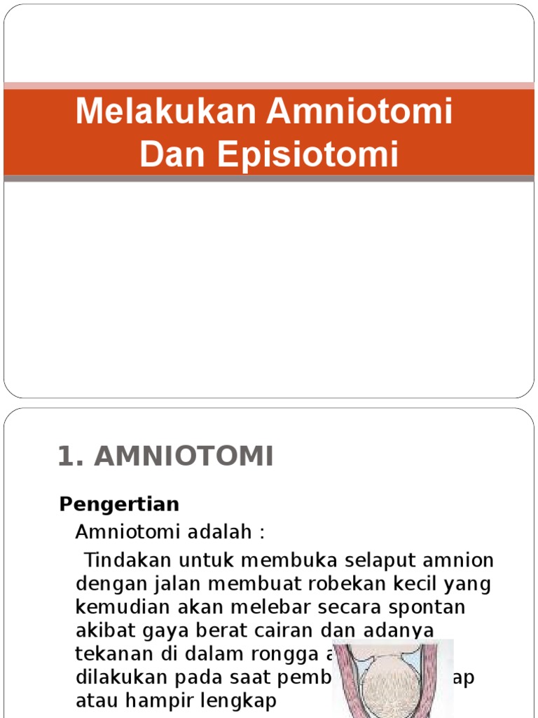 Prosedur Amniotomi dan Episiotomi | PDF