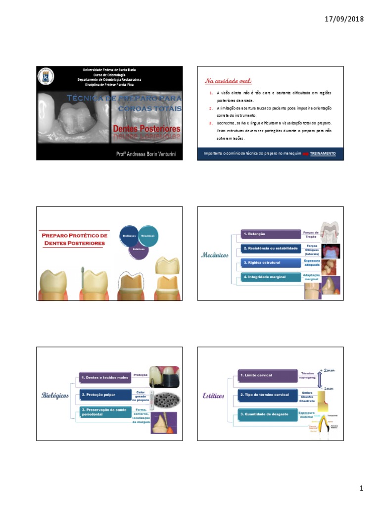 Técnica de Preparo para Coroa Total - Dentes Posteriores | PDF ...