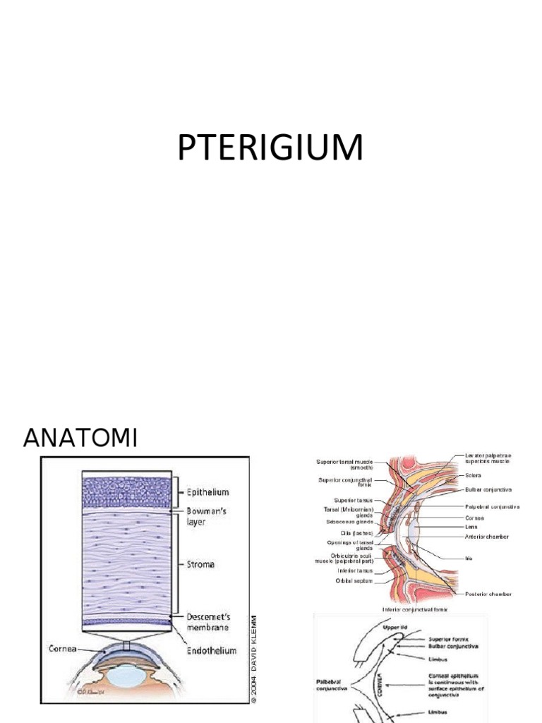 PTERIGIUM | PDF