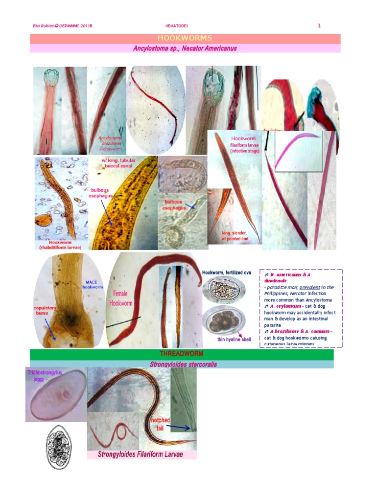 [Intestinal Nematodes (Infective Stage-larvae) & Tissue Nematodes] (1)